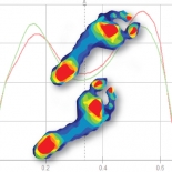 How Pressure Mapping Complements Force Measurement in Gait Analysis ...