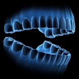 Digital Occlusion Analysis vs. Intraoral Scanners | Tekscan